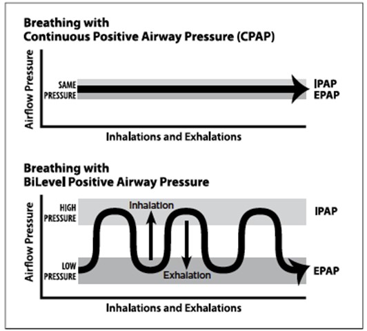 The ABCs of CPAP: the Gold Standard of Care for Sleep Apnea